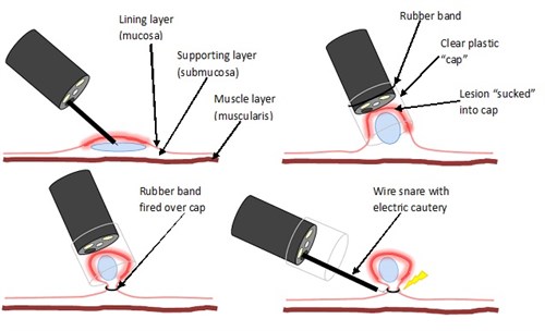 Oesophago-gastric Surgery Team