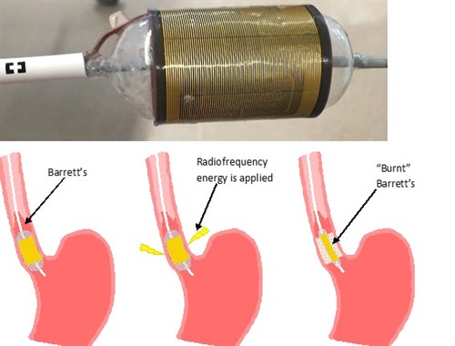 Oesophago-gastric Surgery Team